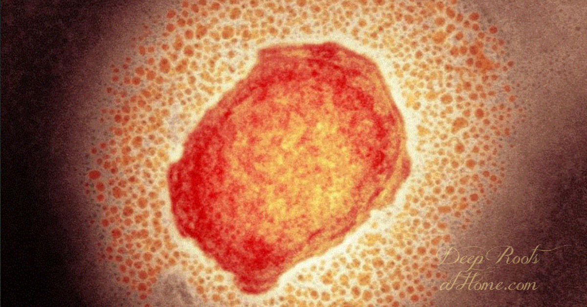 Monkeypox Scare & 12 Natural Remedies To Know To Prepare